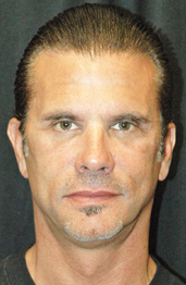 Facelift Case Studies – Lorenzo Lamas Facelift – Before & After